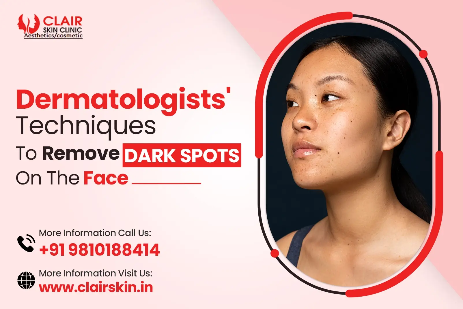 Dermatologists Techniques To Remove Dark Spots On The Face ...