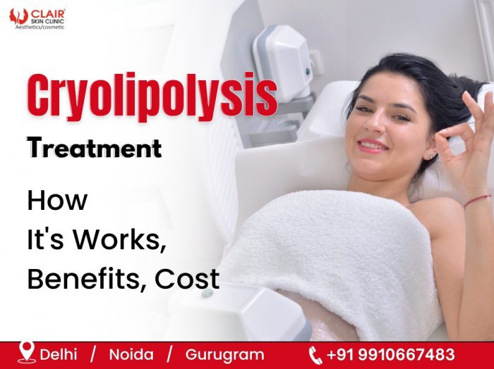 Cryolipolysis Treatment- How It's Works, Benefits, Cost - Dermatologist ...