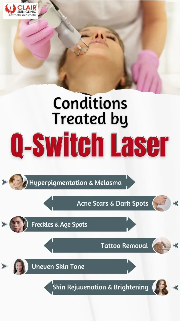 Q Switch Laser Treatment In Delhi | Clair Skin Clinic